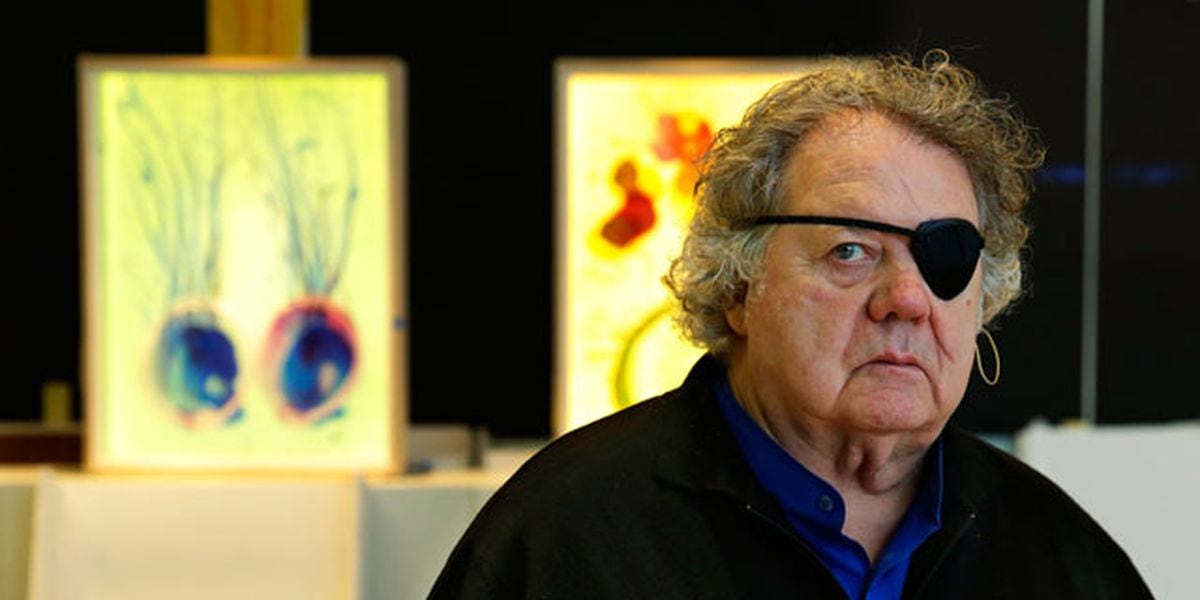 Famed glass artist Dale Chihuly details his struggles with bipolar disorder